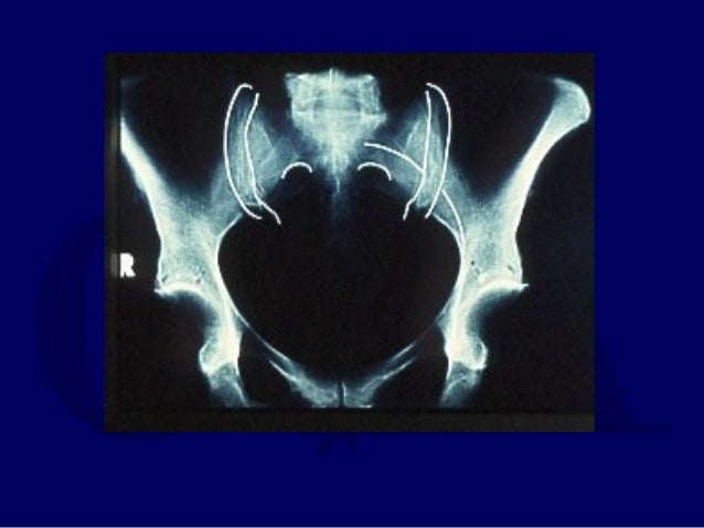 V01 anatomy class_pelvis