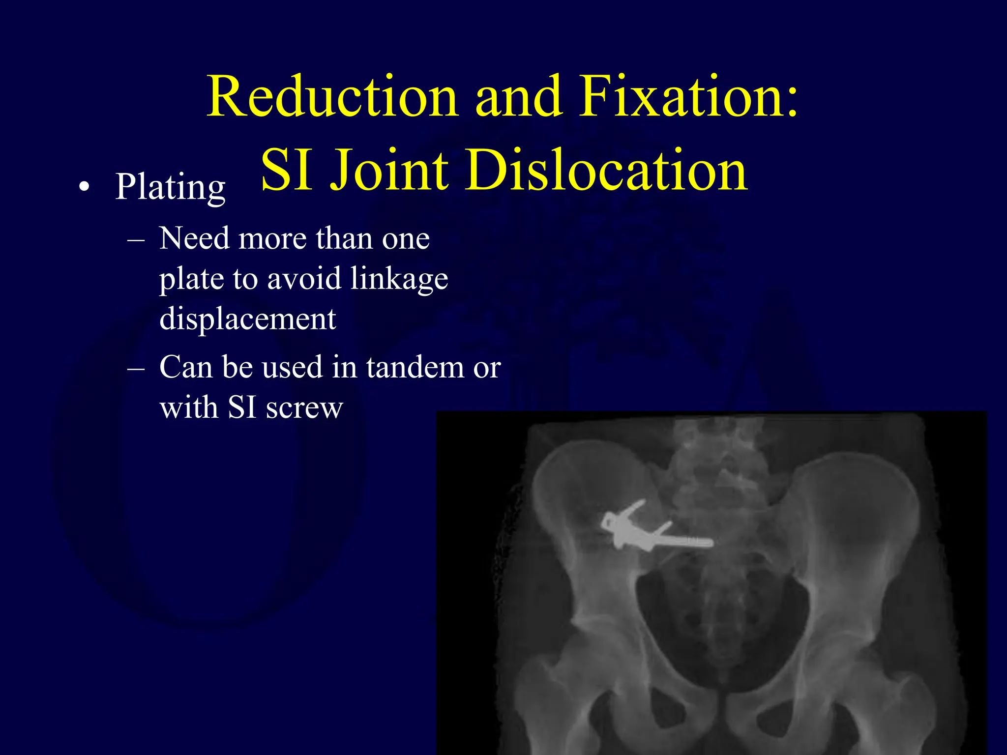 pelvis fractures definitive management.ppt