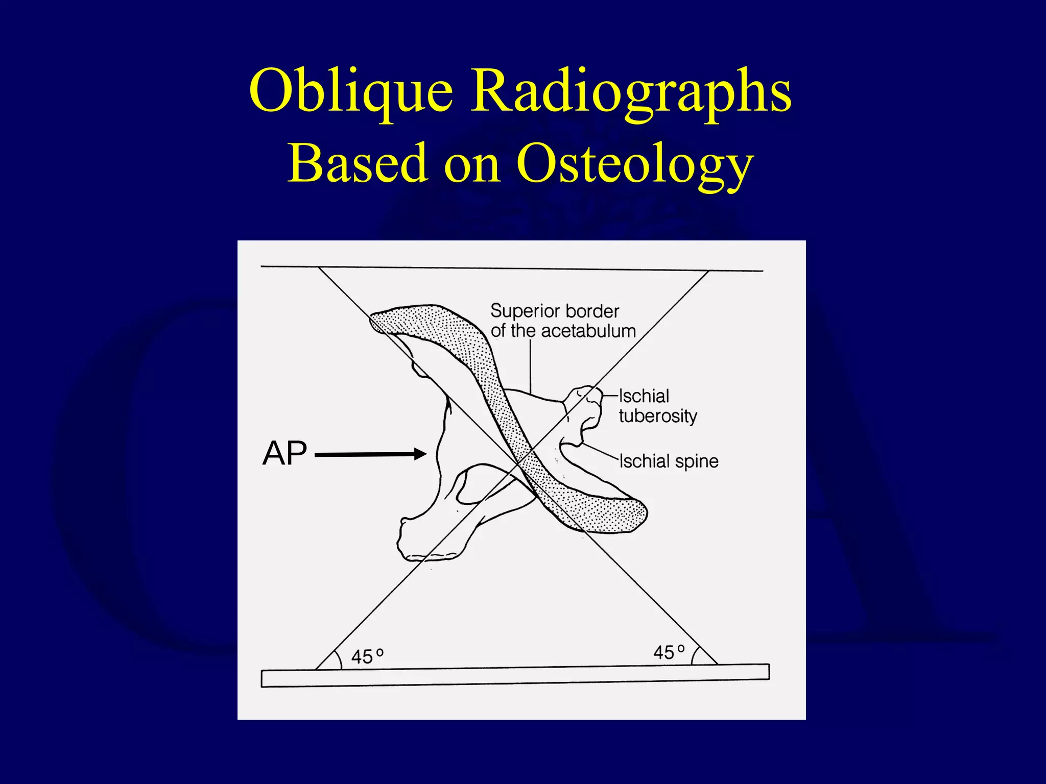 V04 anatomy class_acetab | PPT