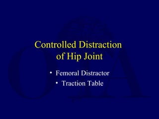 V06 orif acetabulum | PPT