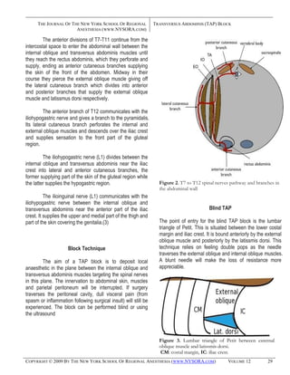 (V12p28 33)tap block | PDF