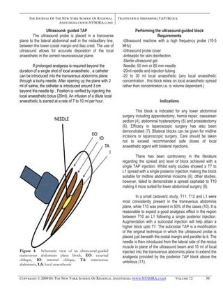 (V12p28 33)tap block | PDF