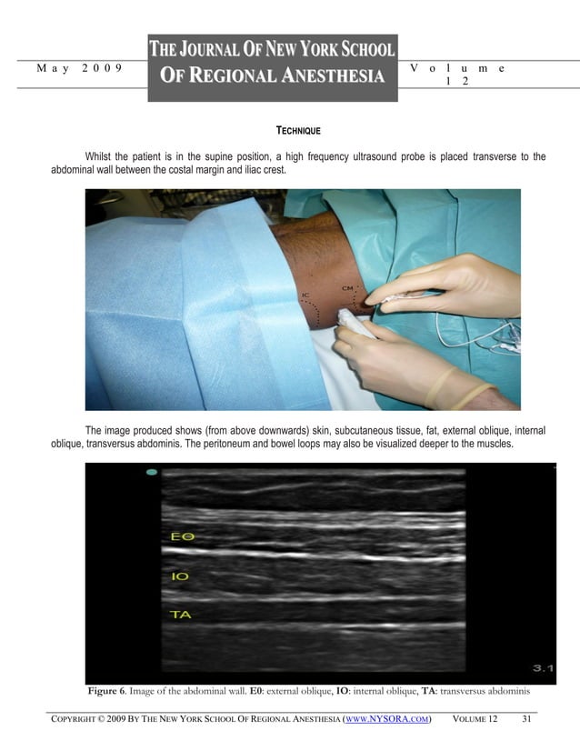 (V12p28 33)tap block | PDF