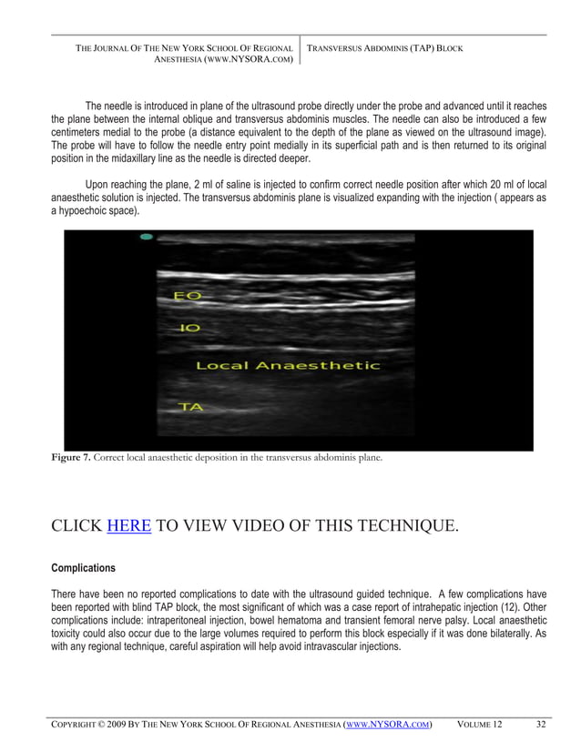 (V12p28 33)tap block | PDF