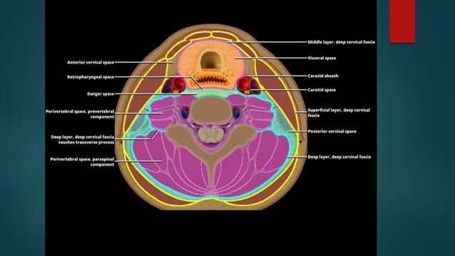 Anatomy of neck spaces | PPTX