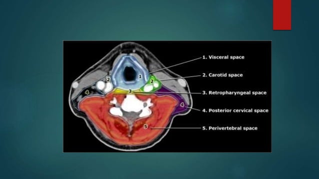 Anatomy of neck spaces | PPTX
