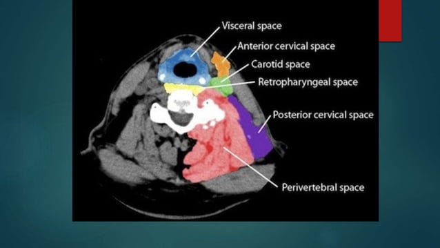 Anatomy of neck spaces | PPTX