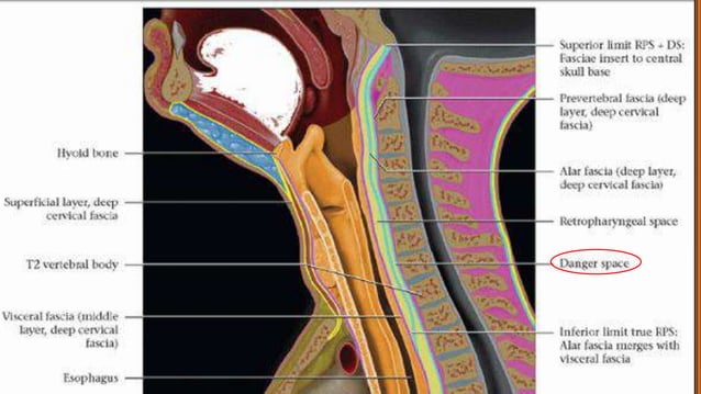 Anatomy of neck spaces | PPTX