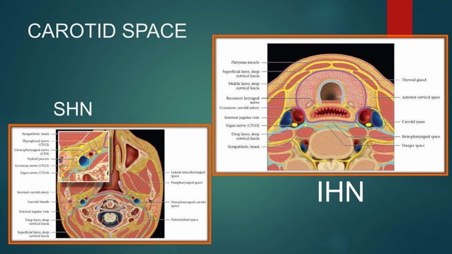 Anatomy of neck spaces | PPTX