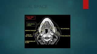Anatomy of neck spaces | PPTX