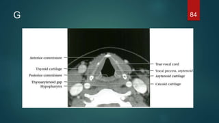 Anatomy of neck spaces | PPTX