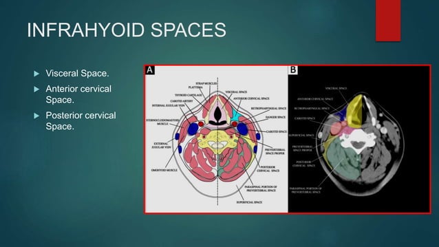 Anatomy of neck spaces | PPTX