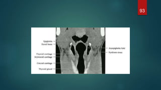 Anatomy of neck spaces | PPTX