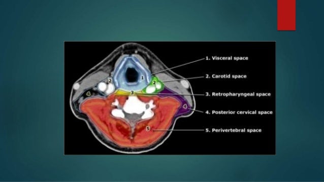 Anatomy of neck spaces