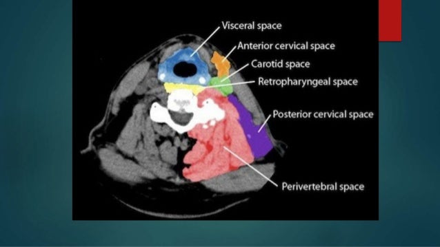 Anatomy of neck spaces