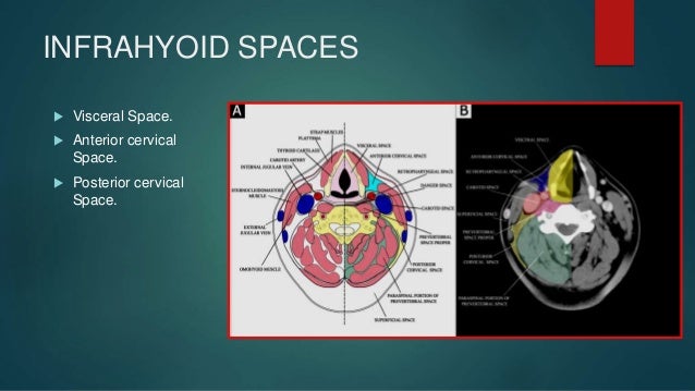 Anatomy Of Neck Spaces