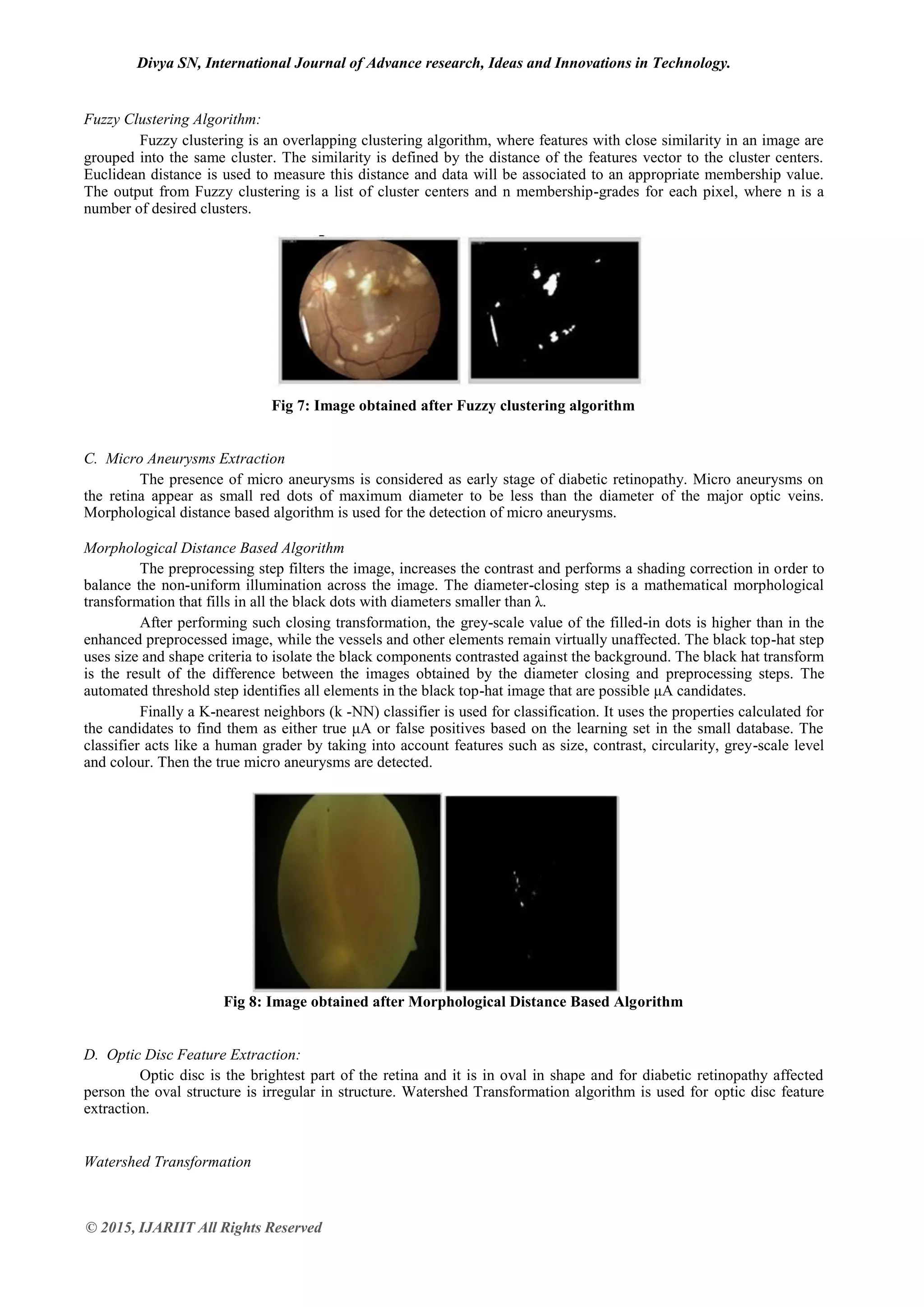Detection Of Diabetic Retinopathy Using Kirsch Edge Detection And Watershed Transformation