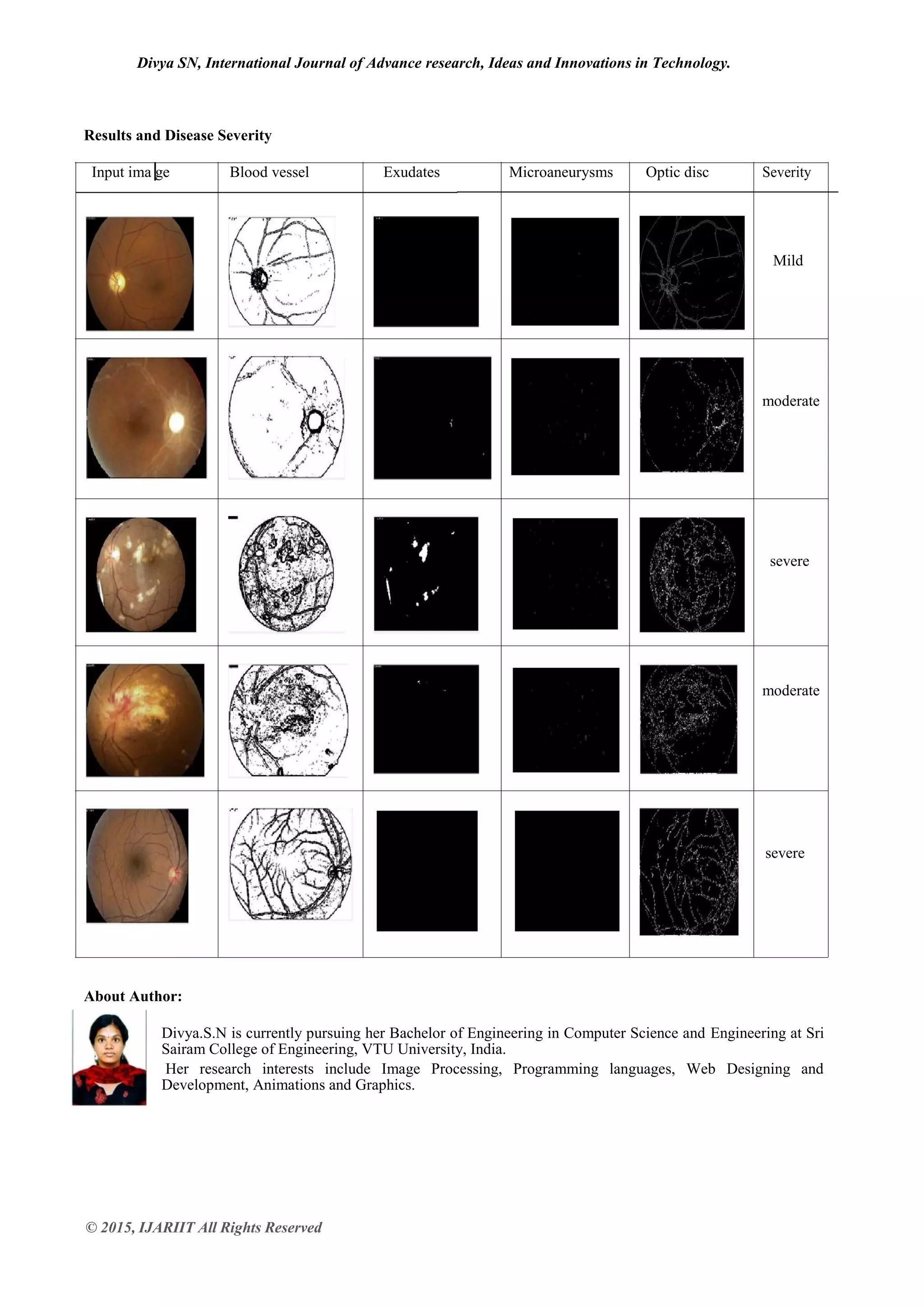 Detection Of Diabetic Retinopathy Using Kirsch Edge Detection And Watershed Transformation