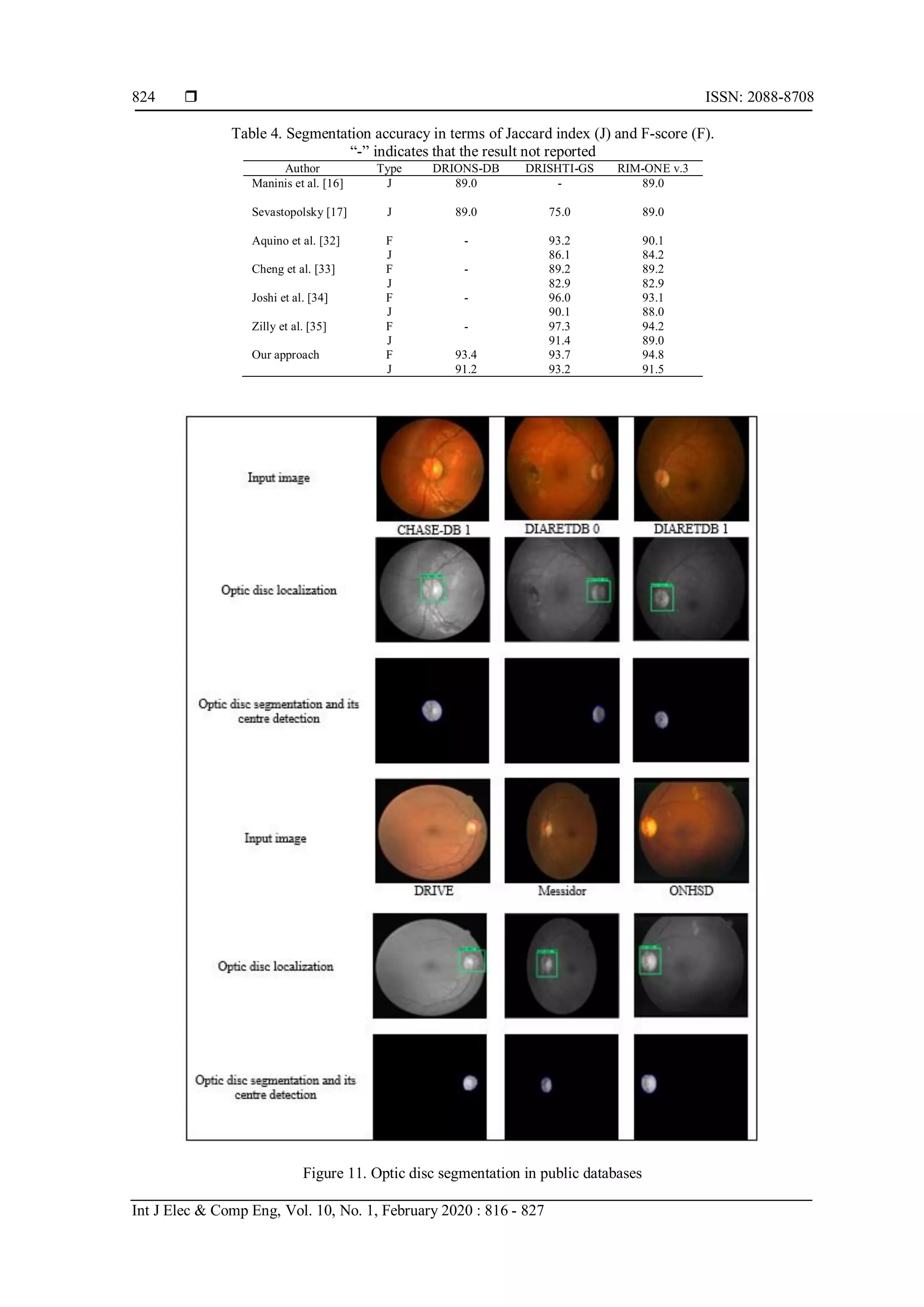 Automated fundus image quality assessment and segmentation of optic disc using convolutional ...