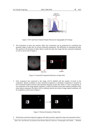 Optic Disc and Macula Localization from Retinal Optical Coherence ...
