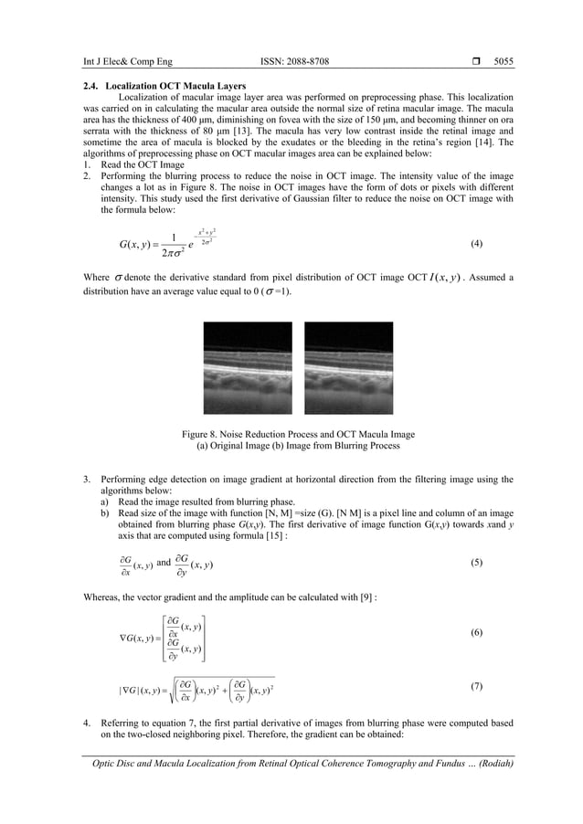Optic Disc And Macula Localization From Retinal Optical Coherence Tomography And Fundus Image Pdf