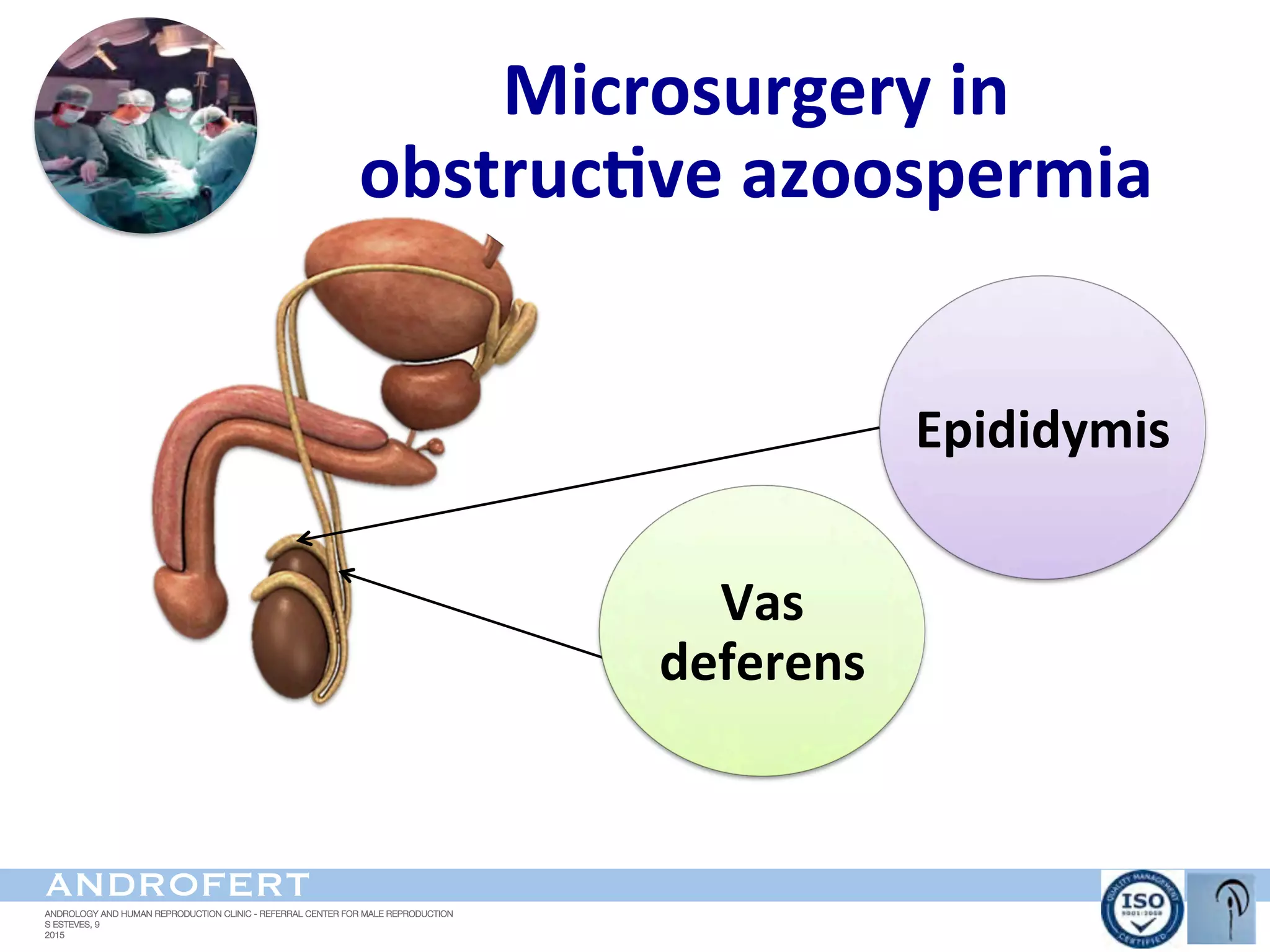 Role of microsurgery in male infertility | PDF