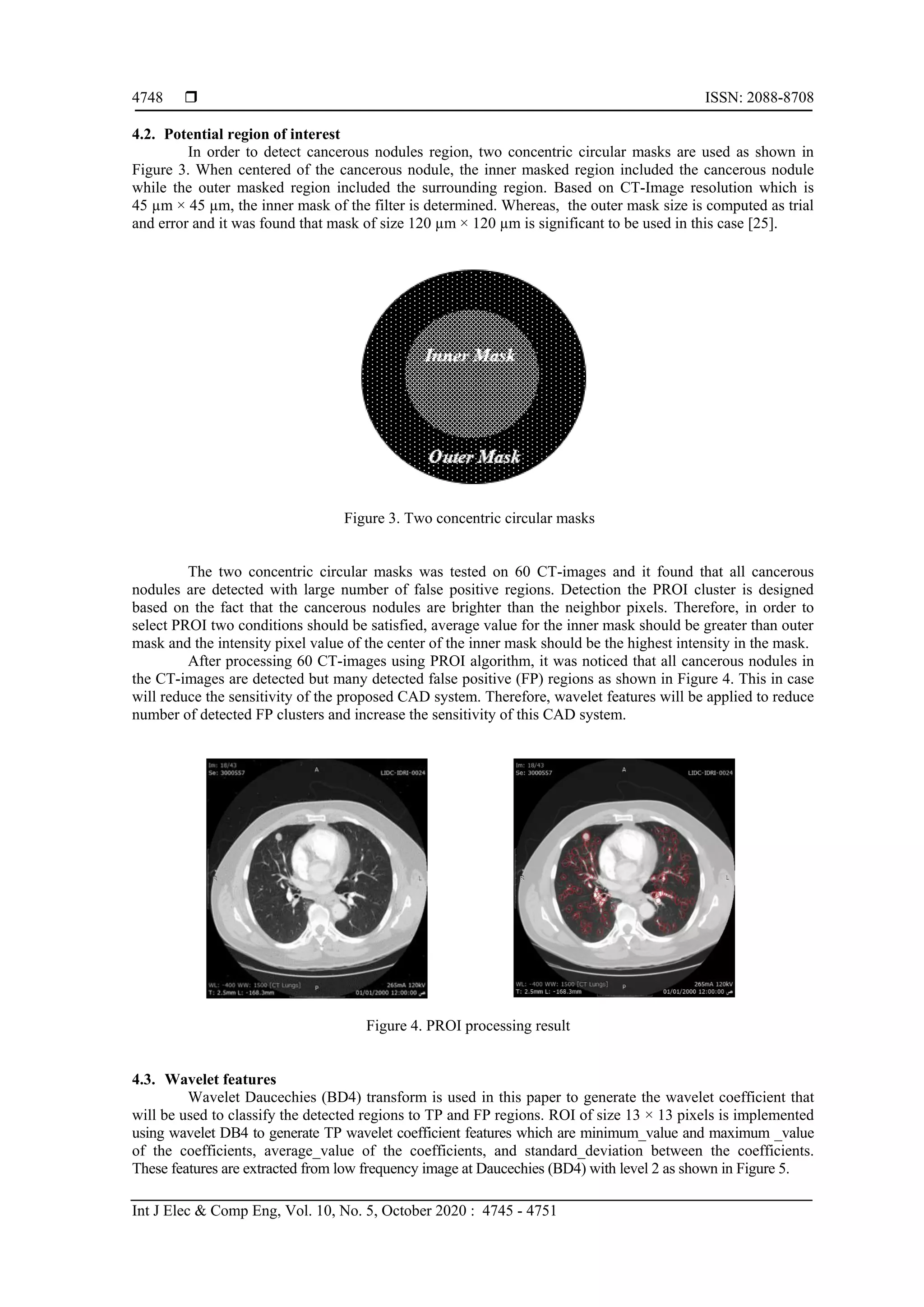 A Novel Cad System To Automatically Detect Cancerous Lung Nodules Using Wavelet Transform And