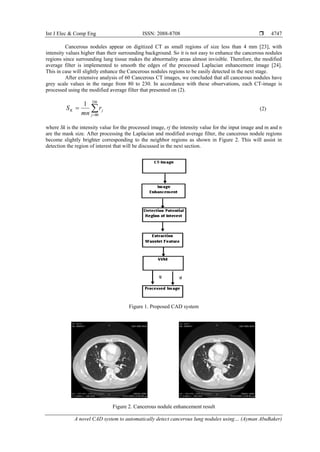 A novel CAD system to automatically detect cancerous lung nodules using wavelet transform and ...
