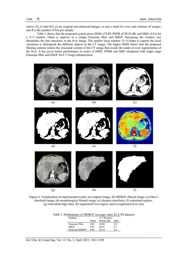 Liver segmentation using marker controlled watershed transform | PDF