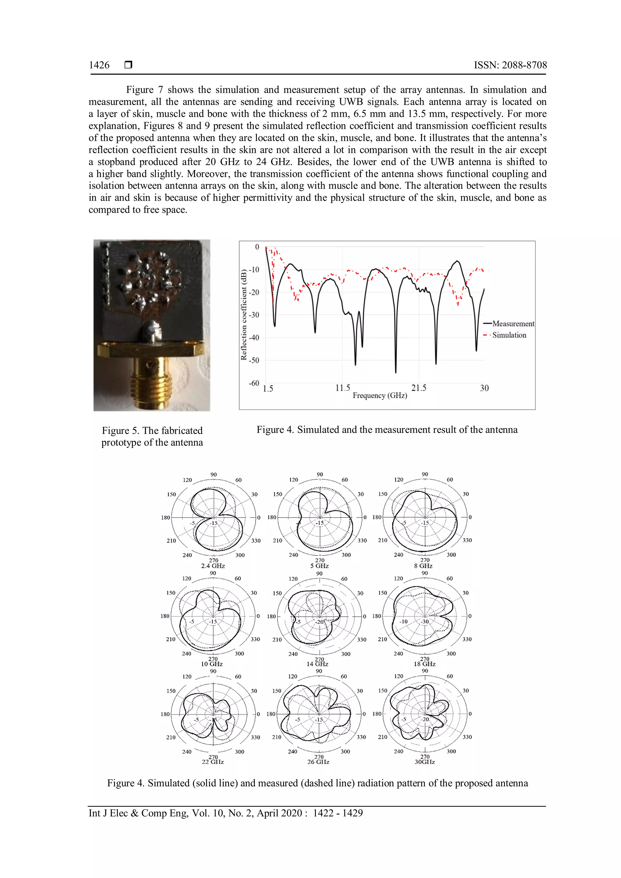 Miniaturized UWB elliptical patch antenna for skin cancer diagnosis ...