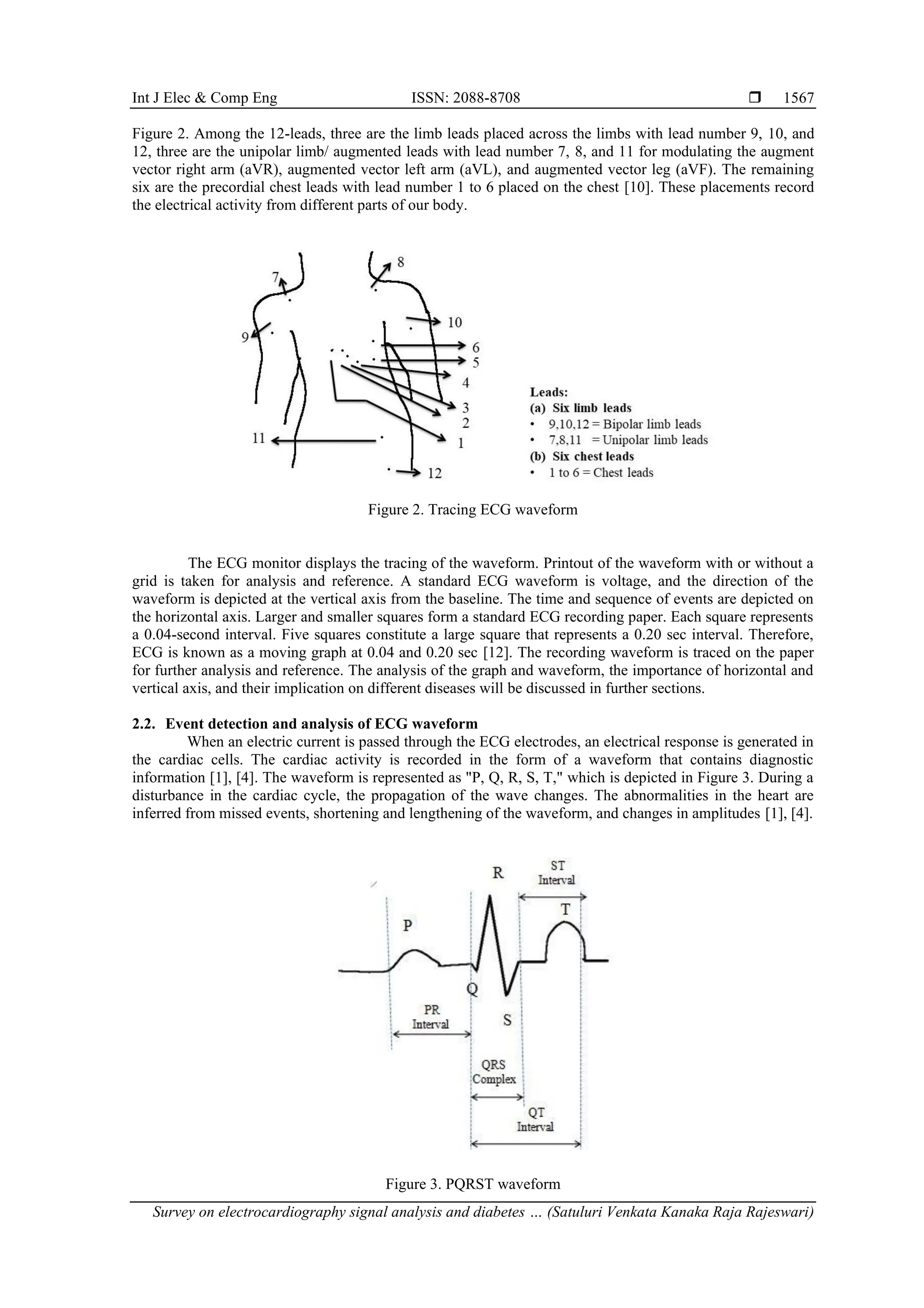 Survey on electrocardiography signal analysis and diabetes mellitus ...