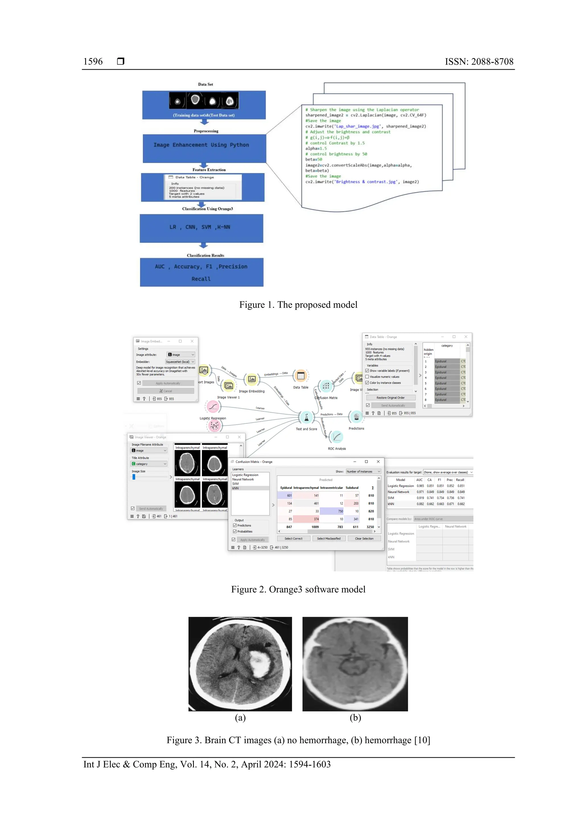 An automated system for classifying types of cerebral hemorrhage based on image processing ...