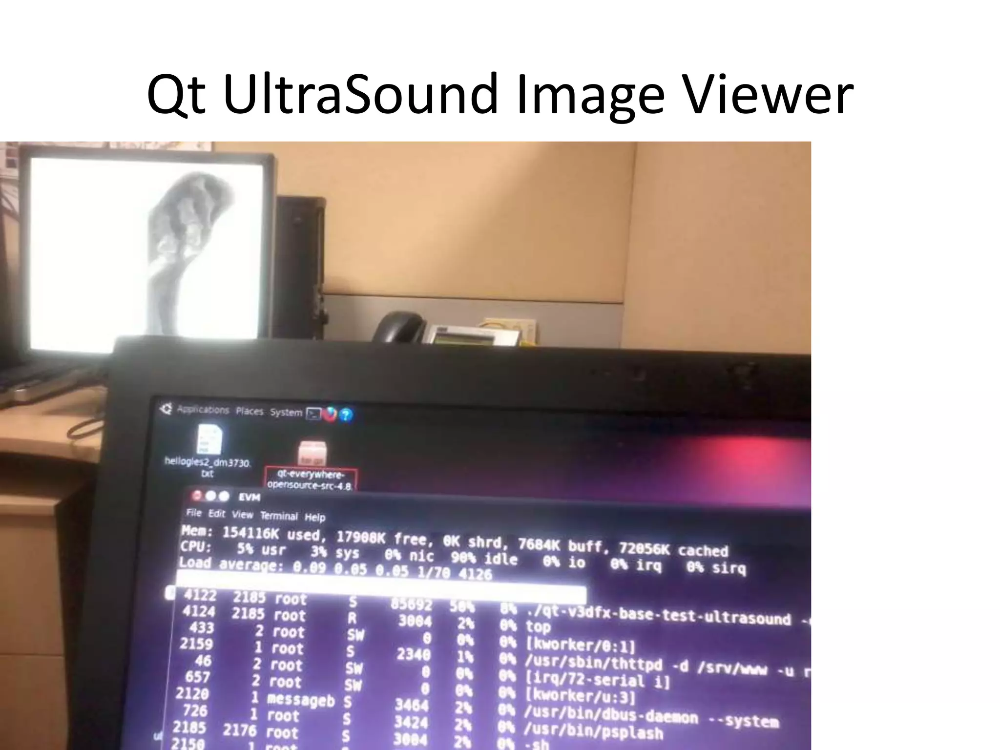 Ultrasound Image Viewer - Qt + SGX | PPTX