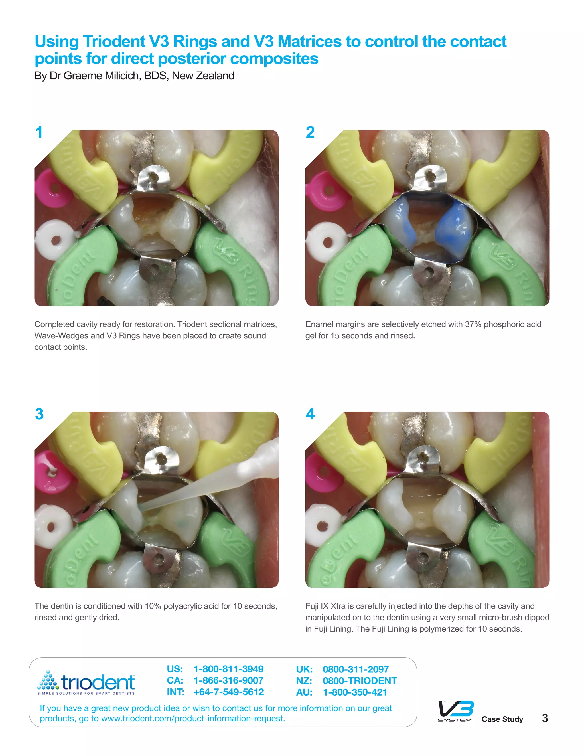 V3 Contact Points by Dr Graeme Milicich | PDF