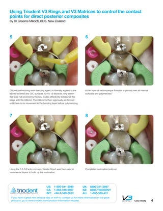 V3 Contact Points by Dr Graeme Milicich | PDF