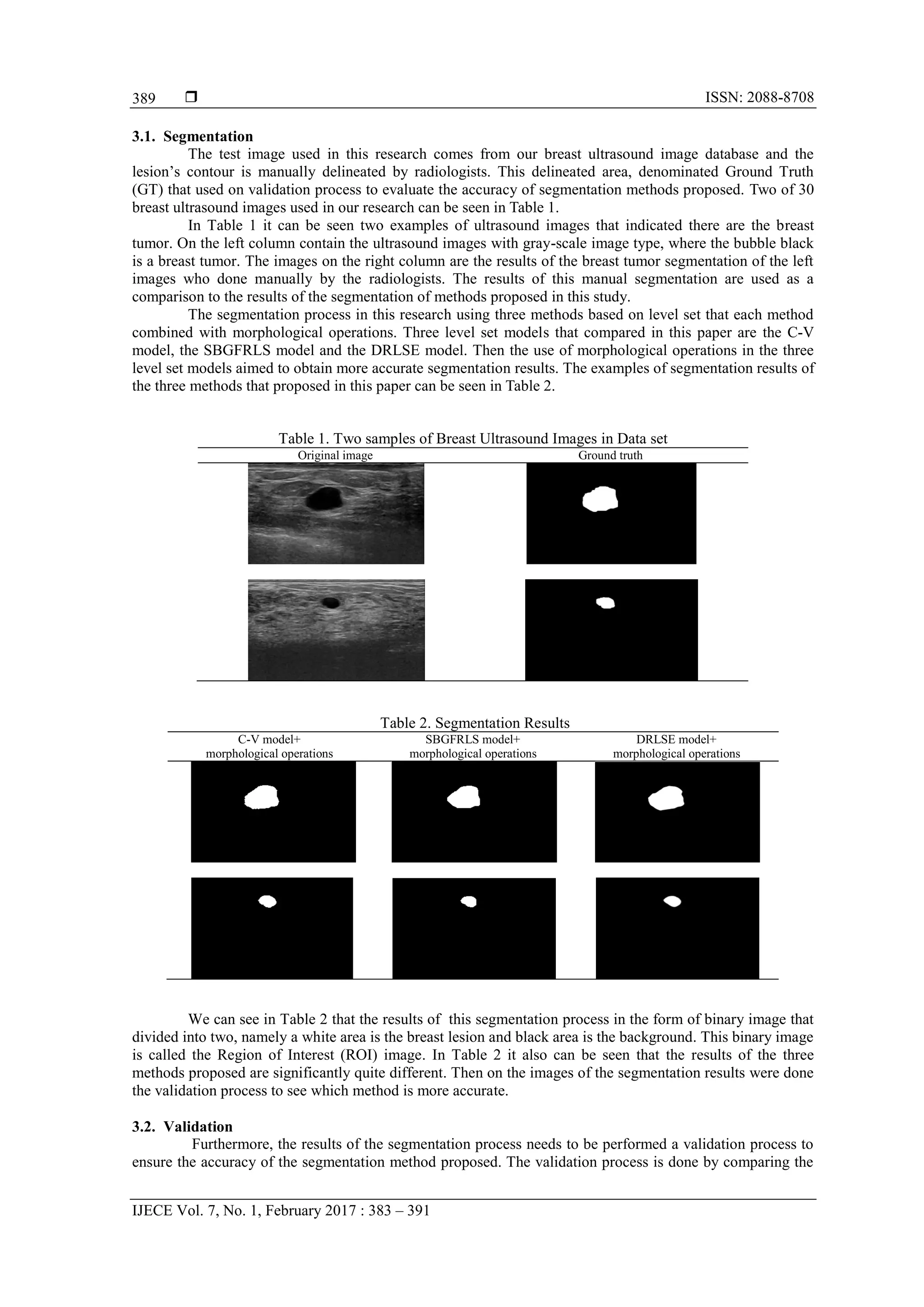 Comparison of Three Segmentation Methods for Breast Ultrasound Images Based on Level Set and ...