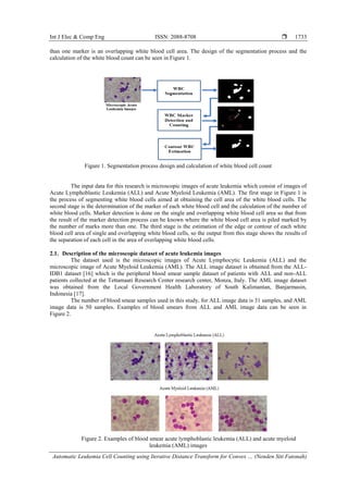 Automatic Leukemia Cell Counting using Iterative Distance Transform for Convex Sets | PDF