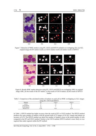 Automatic Leukemia Cell Counting using Iterative Distance Transform for Convex Sets | PDF