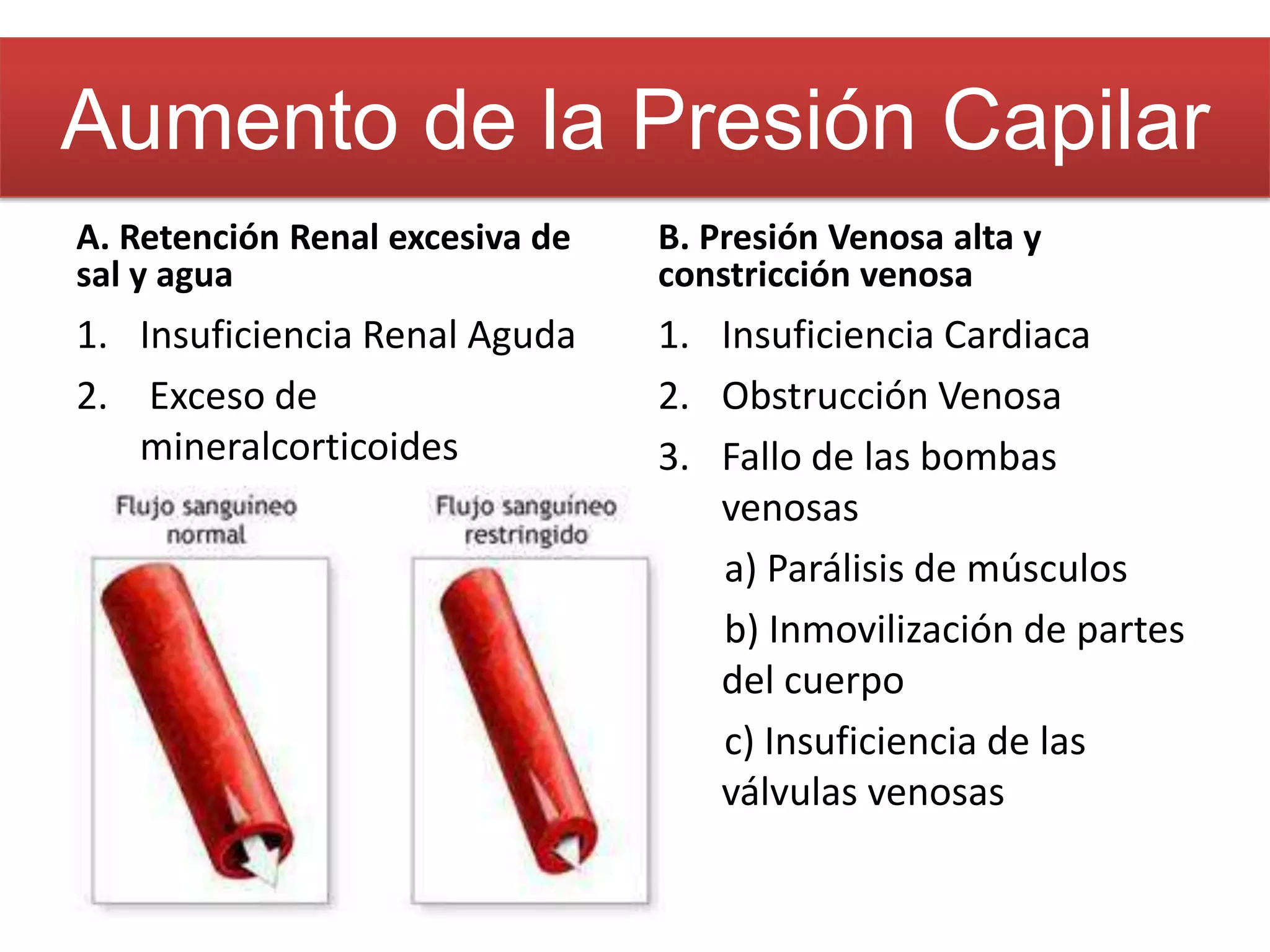 V4 b signos y síntomas, fisiopatología de los diferentes tipos de edema ...