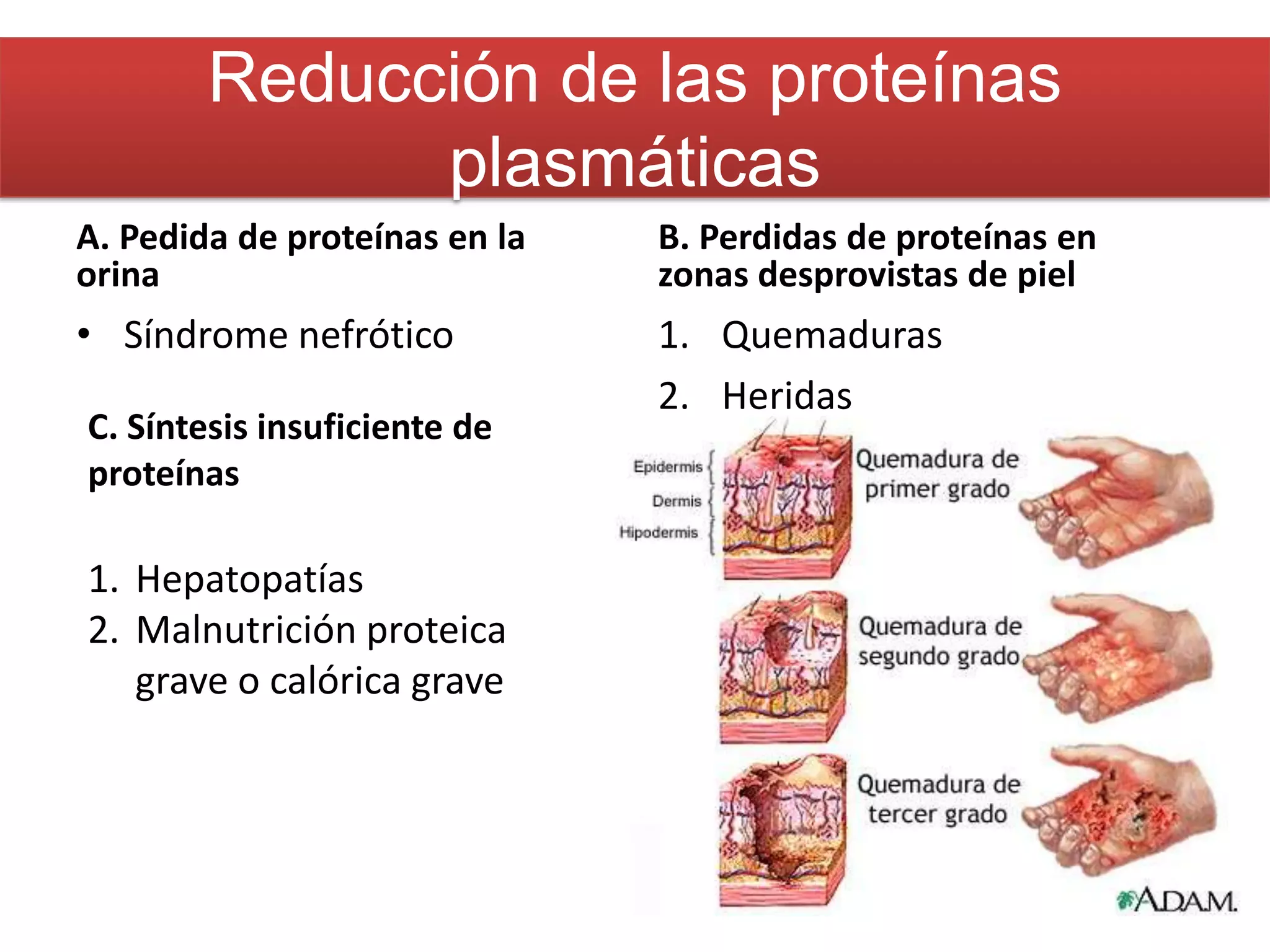 V4 b signos y síntomas, fisiopatología de los diferentes tipos de edema ...