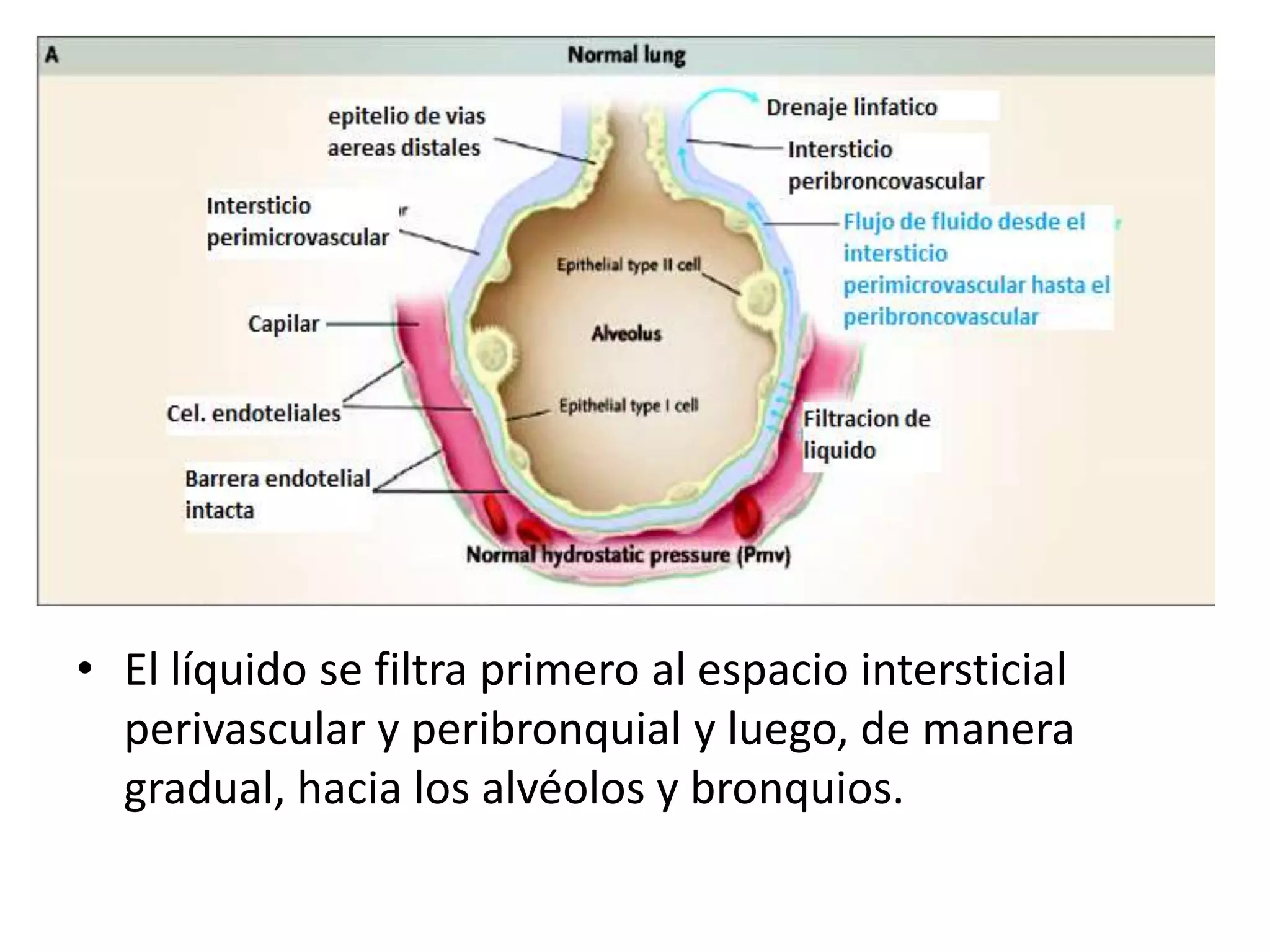 V4 b signos y síntomas, fisiopatología de los diferentes tipos de edema ...