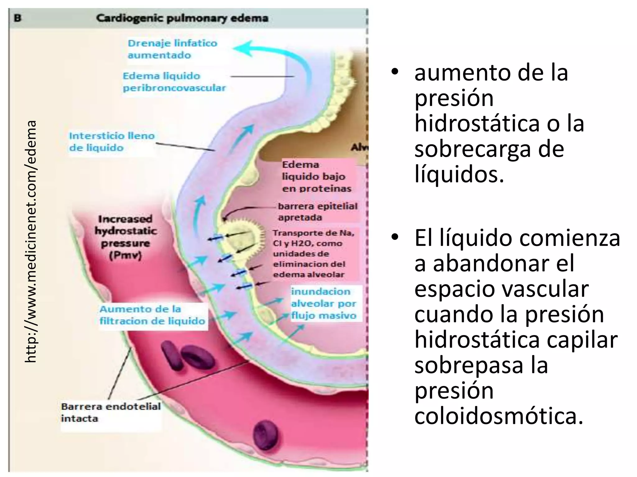 V4 b signos y síntomas, fisiopatología de los diferentes tipos de edema ...