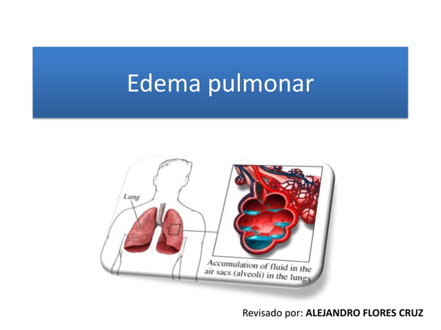 V4 b signos y síntomas, fisiopatología de los diferentes tipos de edema ...