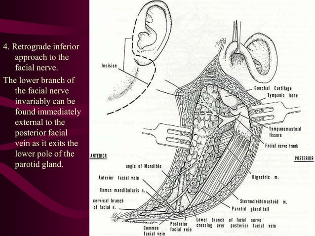 saliv_gland_tumors.pptxg kamel Kalam Kalam | PPT