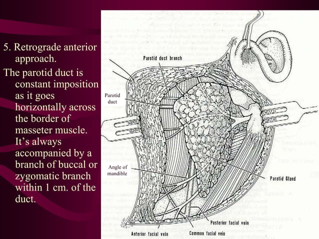saliv_gland_tumors.pptxg kamel Kalam Kalam | PPT