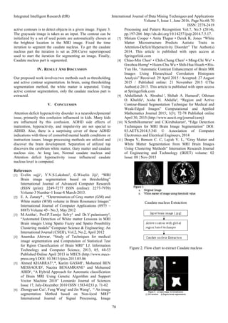 Brain Image Segmentation Methods using Image Processing Techniques to Analysis ADHD | PDF