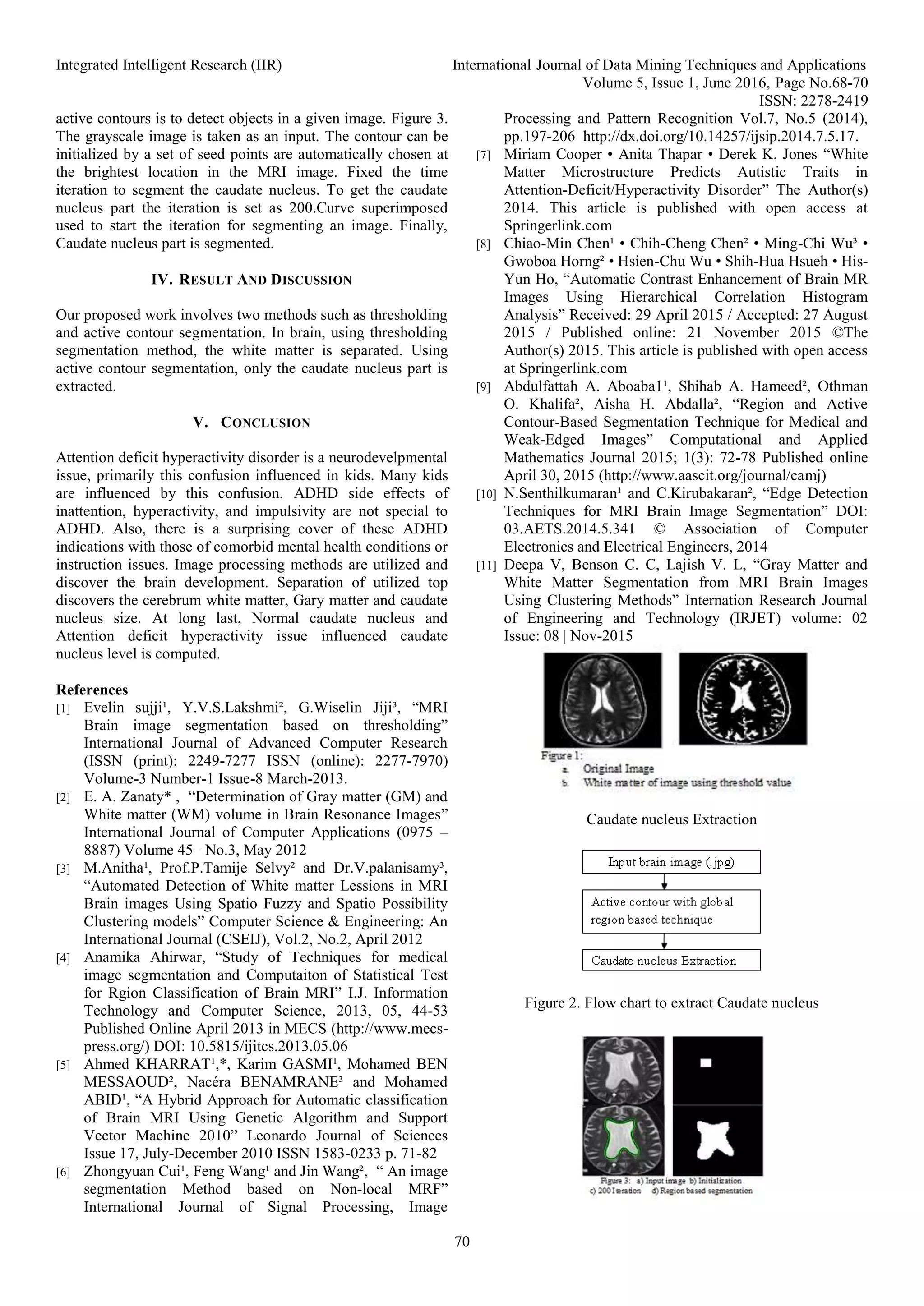 Brain Image Segmentation Methods using Image Processing Techniques to Analysis ADHD | PDF