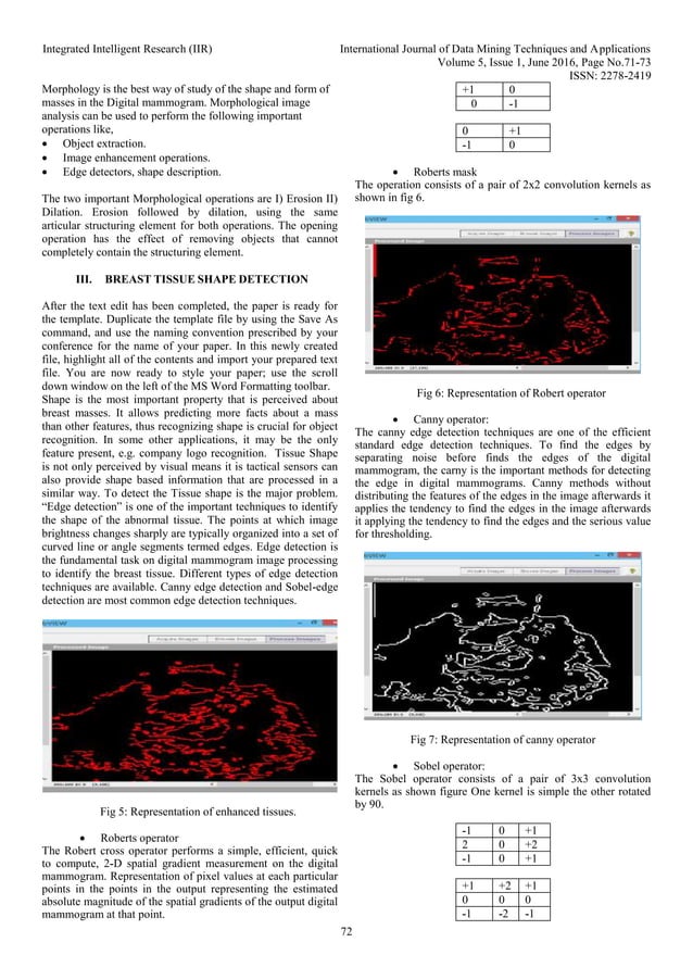 Breast Tissue Identification In Digital Mammogram Using Edge Detection Techniques Pdf
