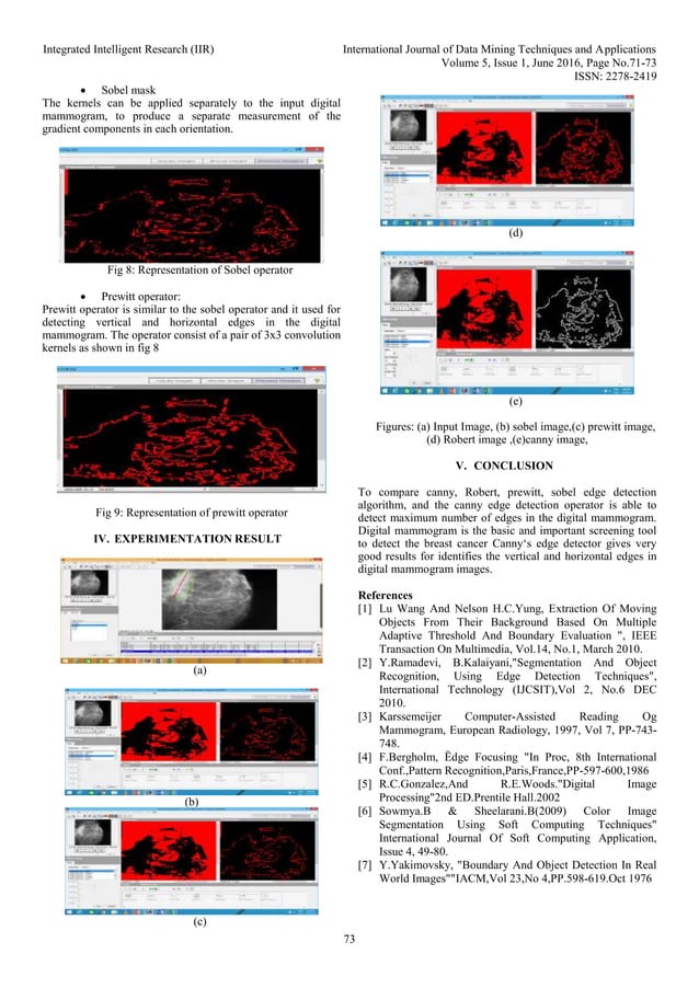 Breast Tissue Identification In Digital Mammogram Using Edge Detection Techniques Pdf