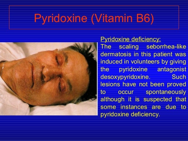 Vitamin B6 Deficiency Symptoms In Adults